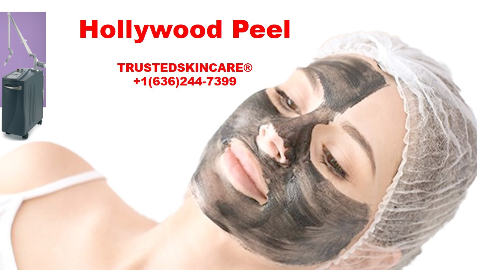 Hollywood peel by Medlite C6 - Laser Skincare and Tattoo Removal by ...